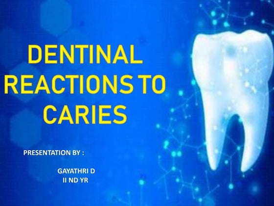 Zones of enamel and dentinal caries completed | PPTX | Dental Health ...