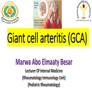 Gaint cell arteritiis (GCA) | PPTX