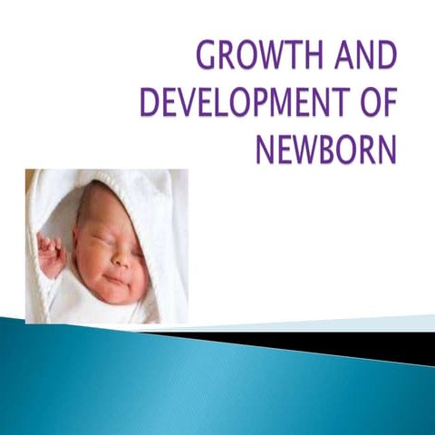 GD OF NEWBORN.ppt