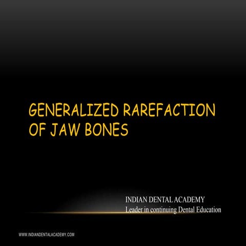 Generalized rarefaction of jaw bones /prosthodontic courses | PPTX