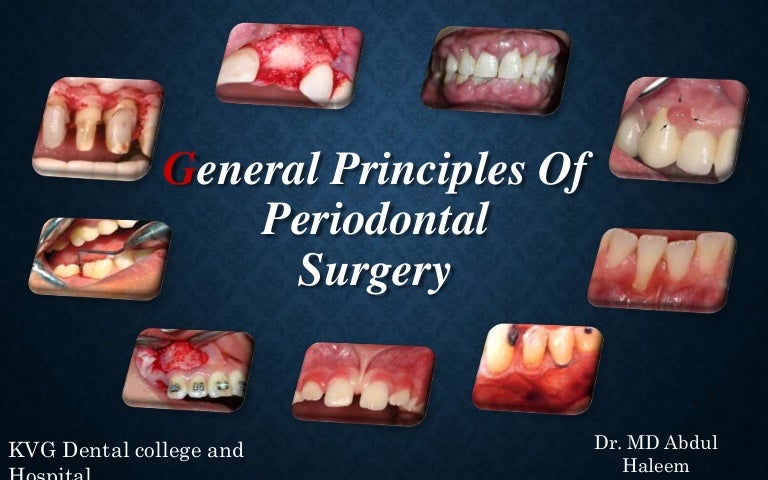 General principles of periodontal surgery