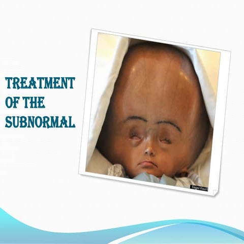 Treatment of the subnormal | PPT