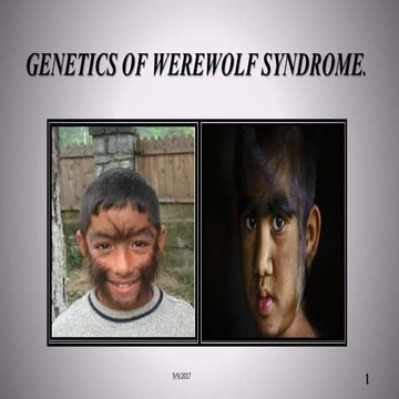Genetics of congenital generalized hypertrichosis | PPTX