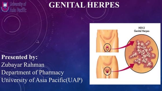 Genital herpes | PPTX | Infectious Diseases | Diseases and Conditions
