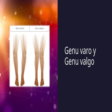 Genu varo y Genu valgo Caracteristicas.pptx