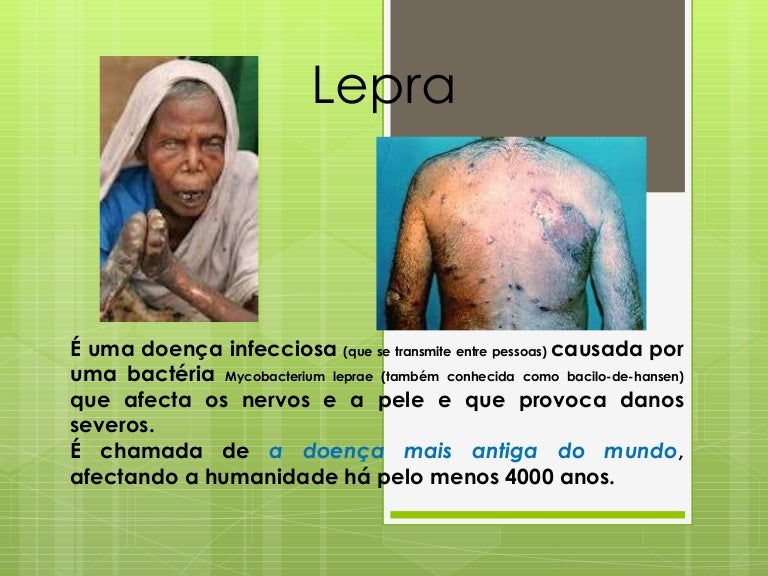 A Lepra e a ajuda aos Leprosos