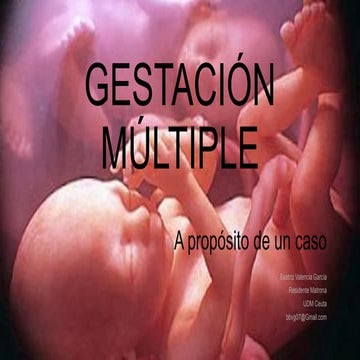 Gestacion multiple | PDF