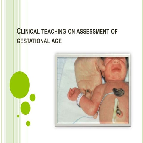 BALLARD SCALE Maturational assessment of gestational age .pptx