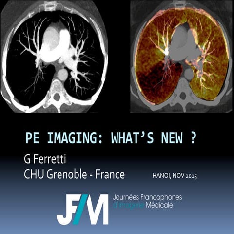 G ferretti pe imaging what’s new jfim hanoi 2015 | PPT