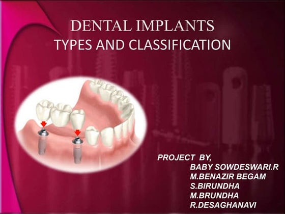 Implant components and function | PPT