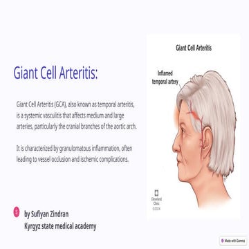 Giant-Cell-Arteritis-A-Comprehensive-Overview.pptx
