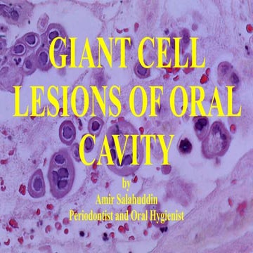 Giant cell lesions of oral cavity | PPTX
