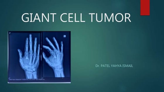 Central giant cell granuloma | PPT