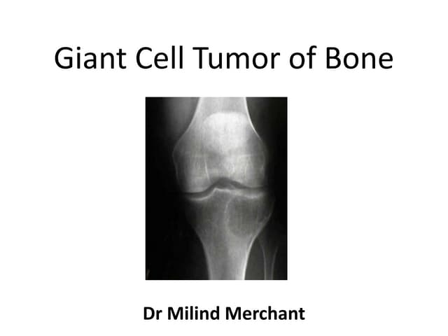 Giant cell tumor | PPTX