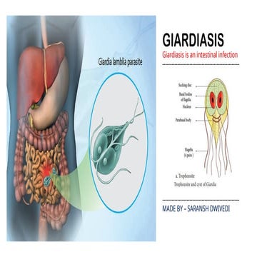 GIARDIASIS PPT -MICROBIOLOGY - BY SARANSH DWIVEDI | PPTX