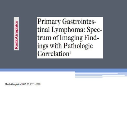 Gastrointestinal lymphoma | PPTX