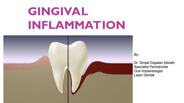 GINGIVAL INFLAMMATION | PPTX