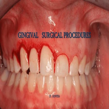 Gingival surgical procedures | PPTX