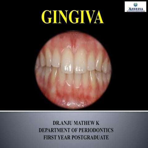 Width of attached gingiva and its significance | PPTX
