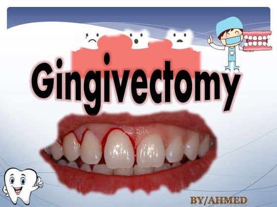Gingivectomy and Gingivoplasty | PPT
