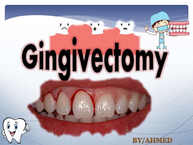 Gingivectomy | PPT