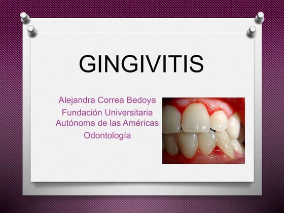 Gingivitis | PPT