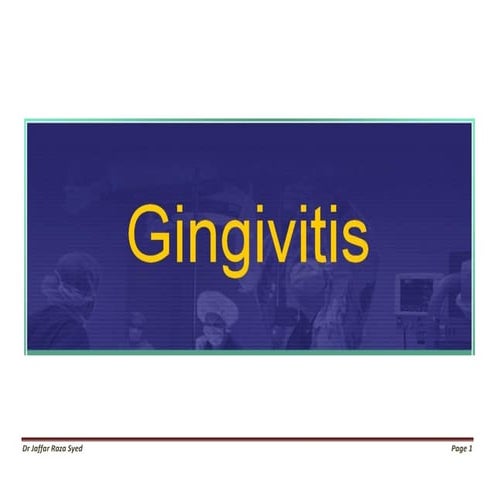 Gingivitis | PPTX