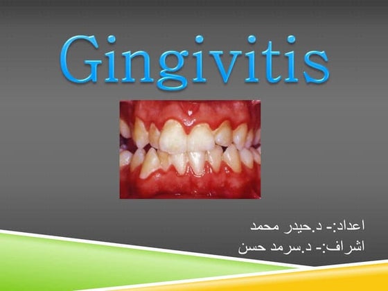 Gingivitis presentation | PPTX | Oral care | Personal Care