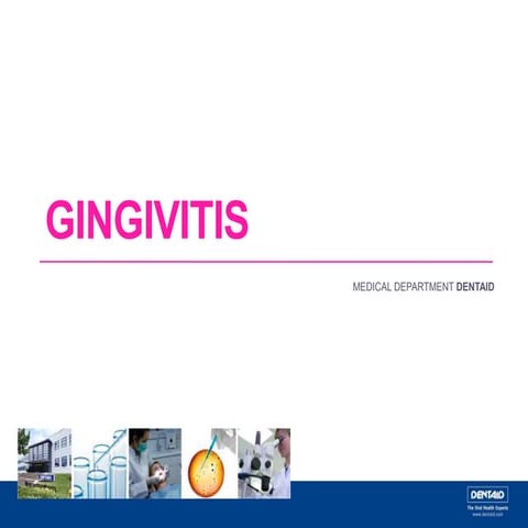 Gingivitis | PPT