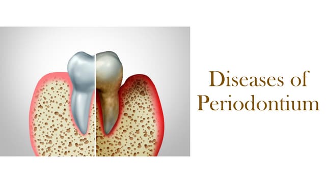 Non plaque induced gingival diseases | PPTX