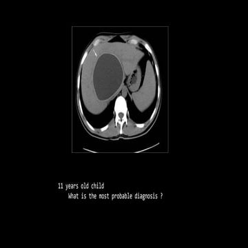 The radiology assistant chest x ray - basic interpretation | PDF