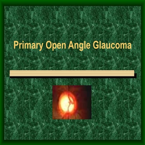 Glaucoma | PPT | Eye and Vision Conditions | Diseases and Conditions
