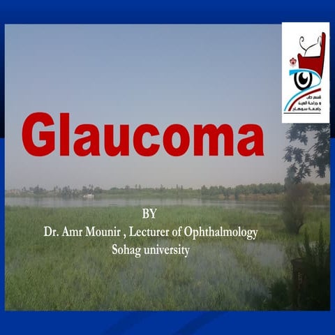Glaucoma | PPT