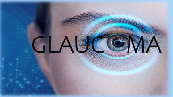 Acute Angle Closure Glaucoma | PPT