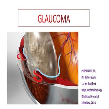 GLAUCOMA. Introduction to basis of glaucoma | PPT