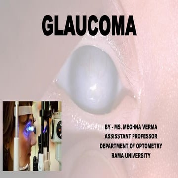 GLAUCOMA.pdf | Eye and Vision Conditions | Diseases and Conditions