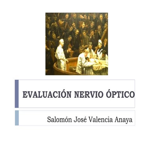 Glaucoma evaluación del nervio óptico, glaucoma neonatal y manitol | PPTX