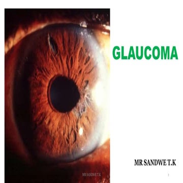 GLAUCOMA FOR NURSES-SANDWE | PPTX