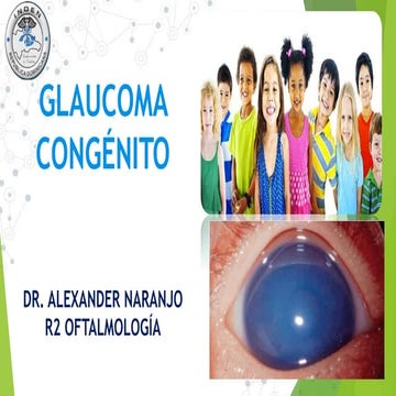 Glaucoma CONGENITO.pptx