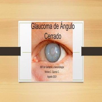 Glaucoma de ángulo cerrado | PPTX