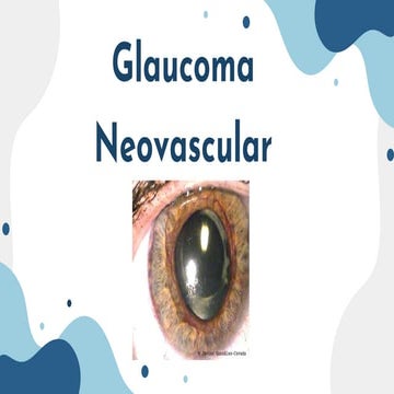 GLAUCOMA_NEOVASCULAR_UCB.pptx