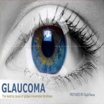 Glaucoma ppt. | PPTX