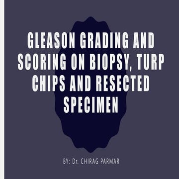 Gleasons scoring system | PPTX