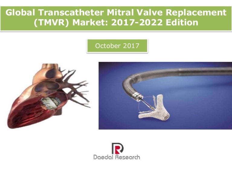 Global Transcatheter Mitral Valve Replacement (TMVR) Market: 2017-202…