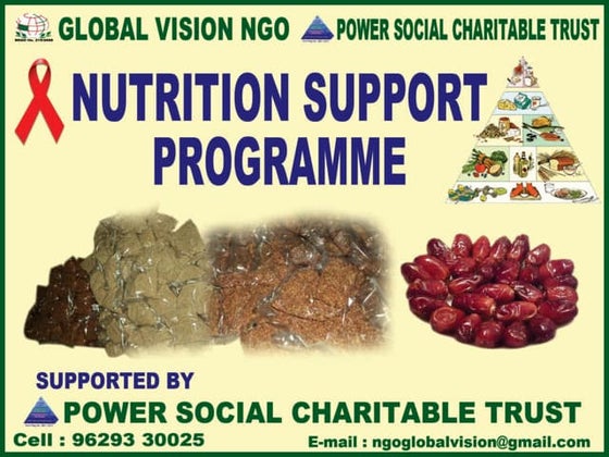 Global vision | PDF