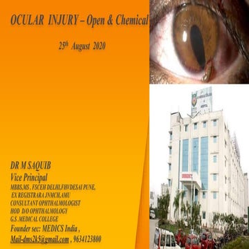 Chemical Injury & Foreign Body Ocular Injury | PPTX