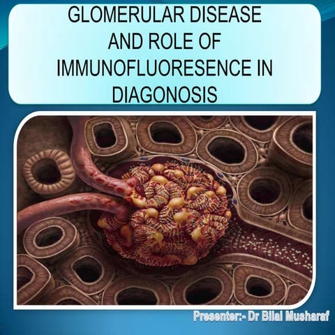 Glomerular diseases | PPTX