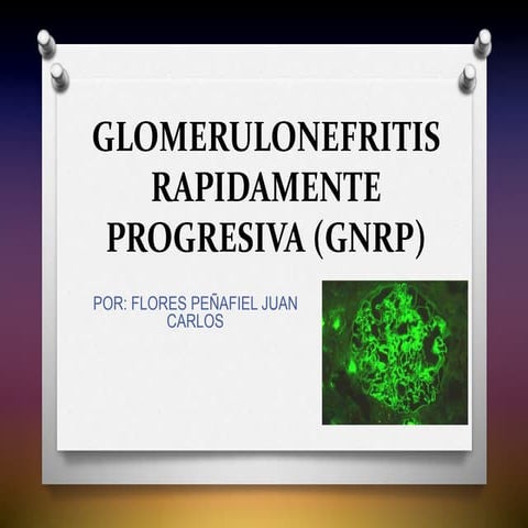 Glomerulonefritis rapidamente progresiva (gnrp) | PPTX