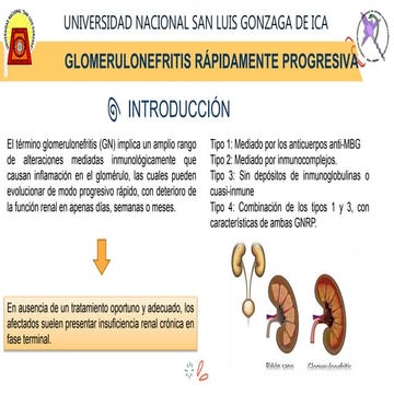GLOMERULONEFRITIS RÁPIDAMENTE PROGRESIVA.pptx