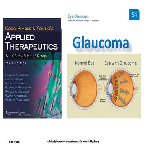 Glaucoma | PDF